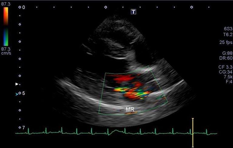 早期の診断が大切です！！ 〜僧帽弁閉鎖不全症（MI、MMVD）ステージB1〜 | おだわら動物病院